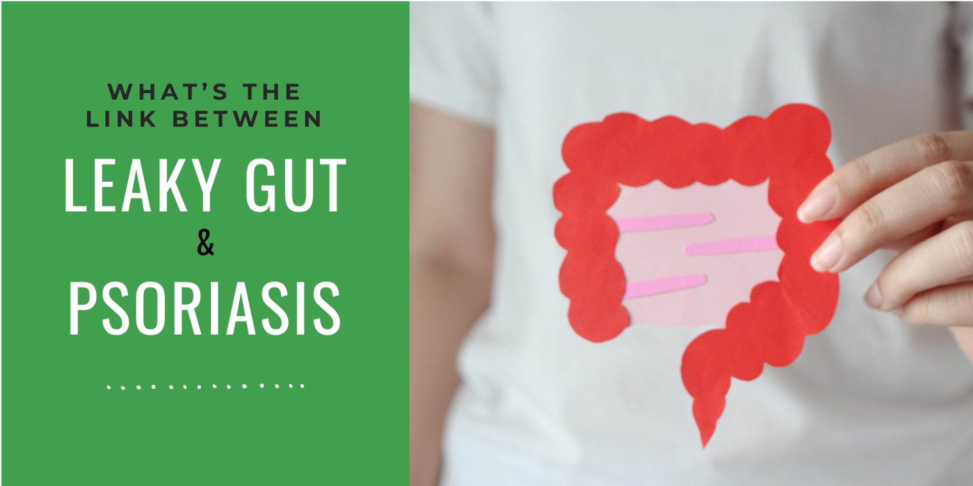 Leaky Gut and Psoriasis: What You Need to Know