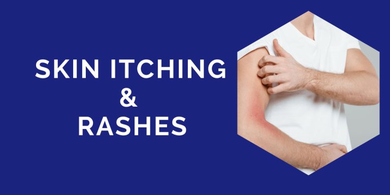 Skin Itching and Rashes: Causes and treatment options