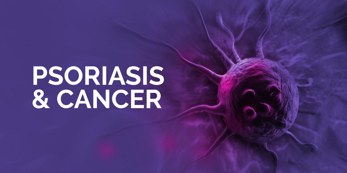 Psoriasis and Cancer: Exploring the Possible Connections