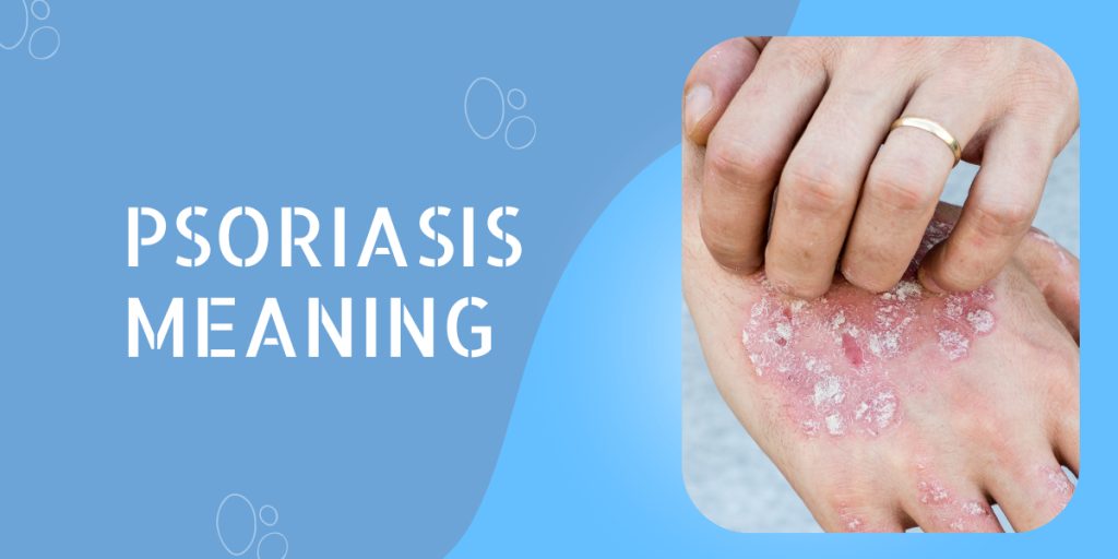 Psoriasis Meaning: Complete Guide to Symptoms & Treatment
