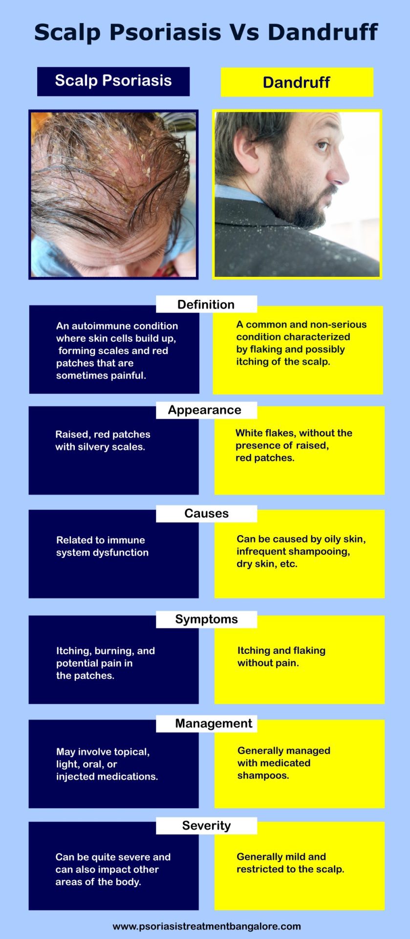 Difference Between Scalp Psoriasis and Dandruff: A Guide