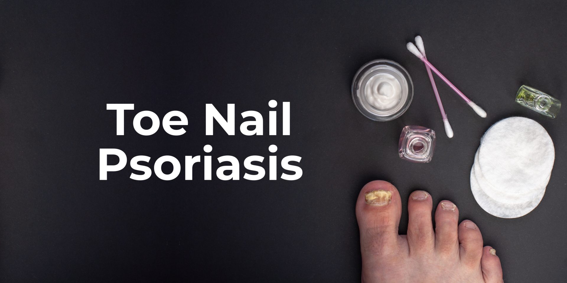 Psoriasis Toenails Treatment